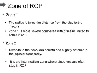 Retinopathy of Primaturity | PPT