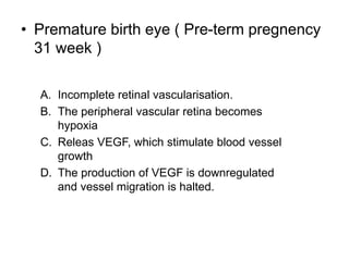 Retinopathy of Primaturity | PPT