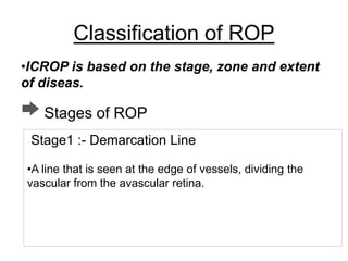 Retinopathy of Primaturity | PPT