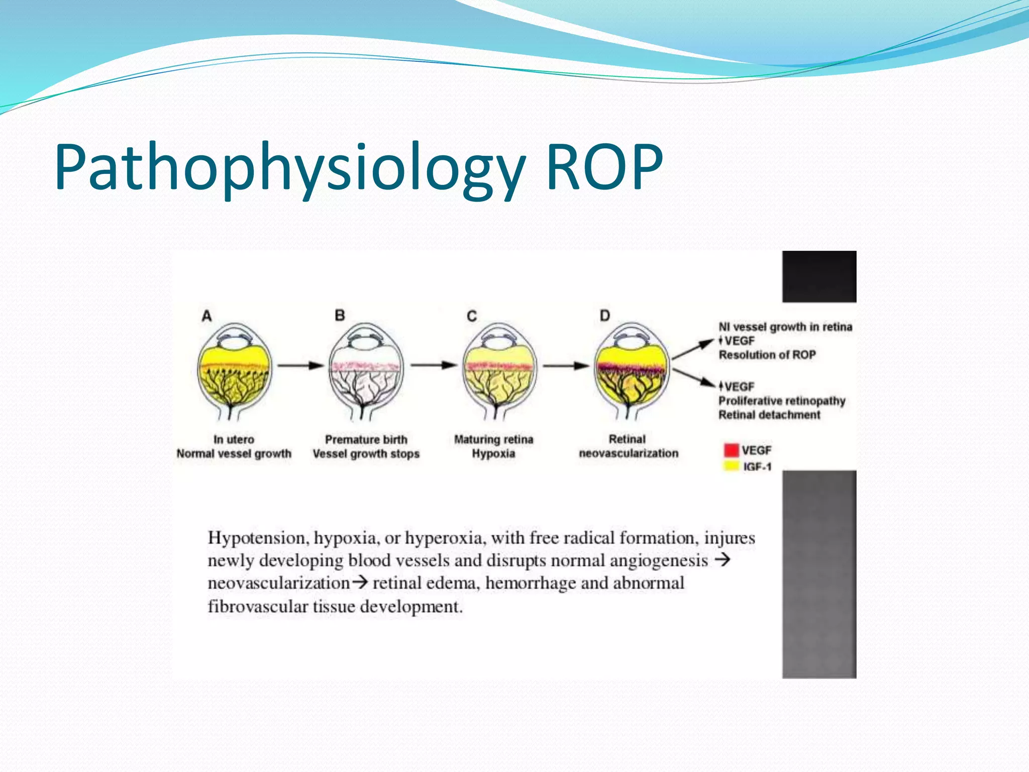 Rop screening ppt | PPTX
