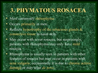 Rosacea | PPT