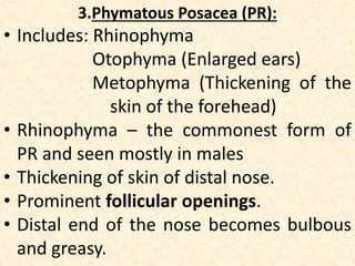 Rosacea: Inflammatory condition in Dermatology | PPTX