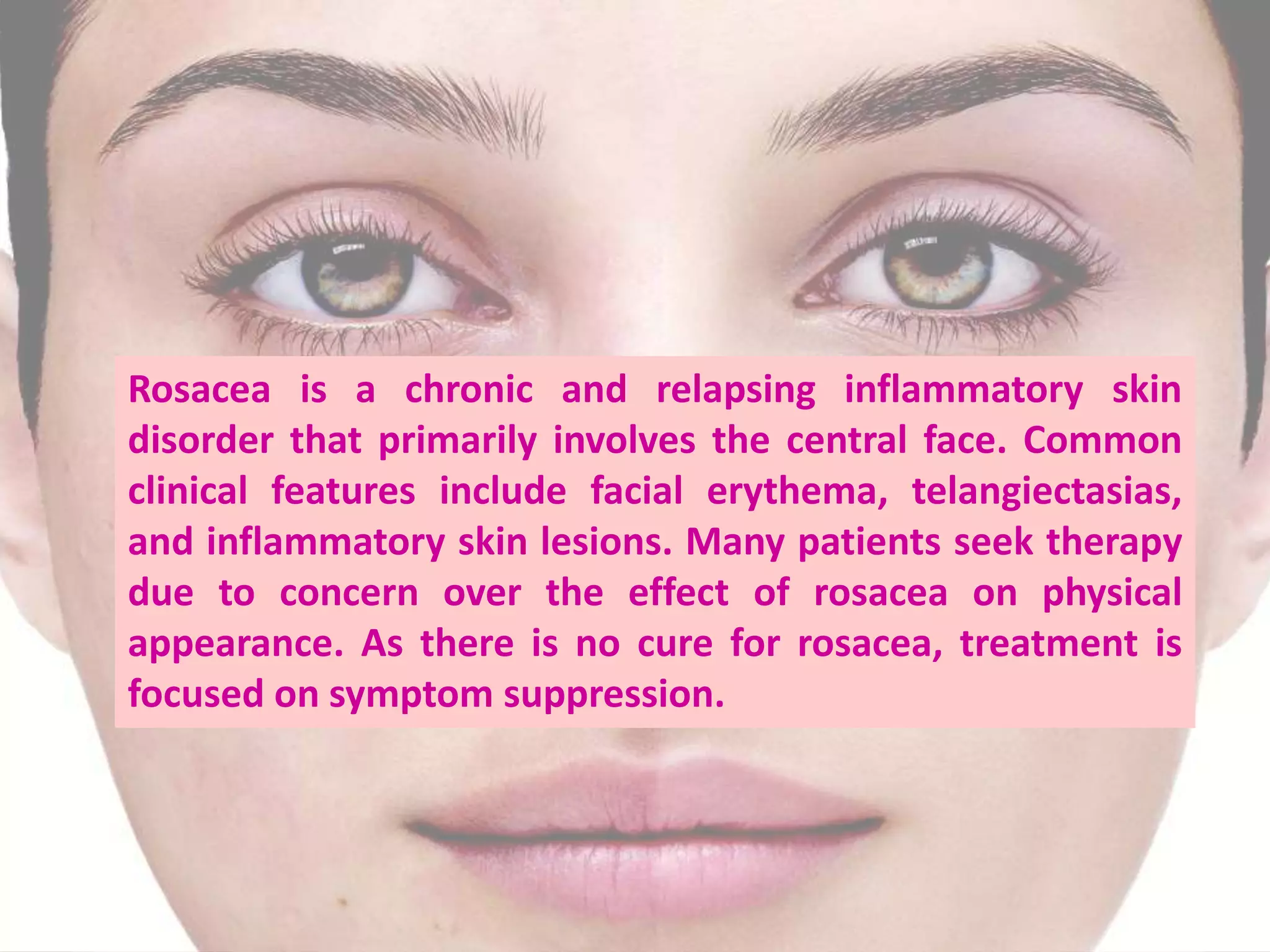 An Update on Rosacea Treatment | PPTX