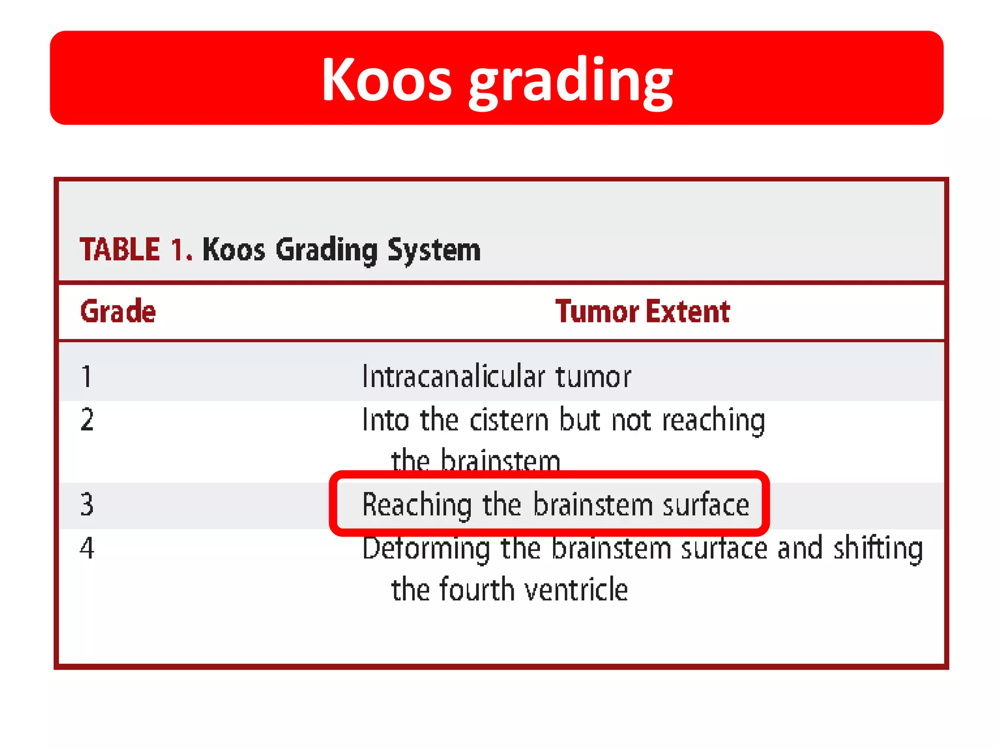 ROSE CASE - STEREOTACTIC RADIOTHERAPY FOR VESTIBULAR SCHWANNOMA | PPTX