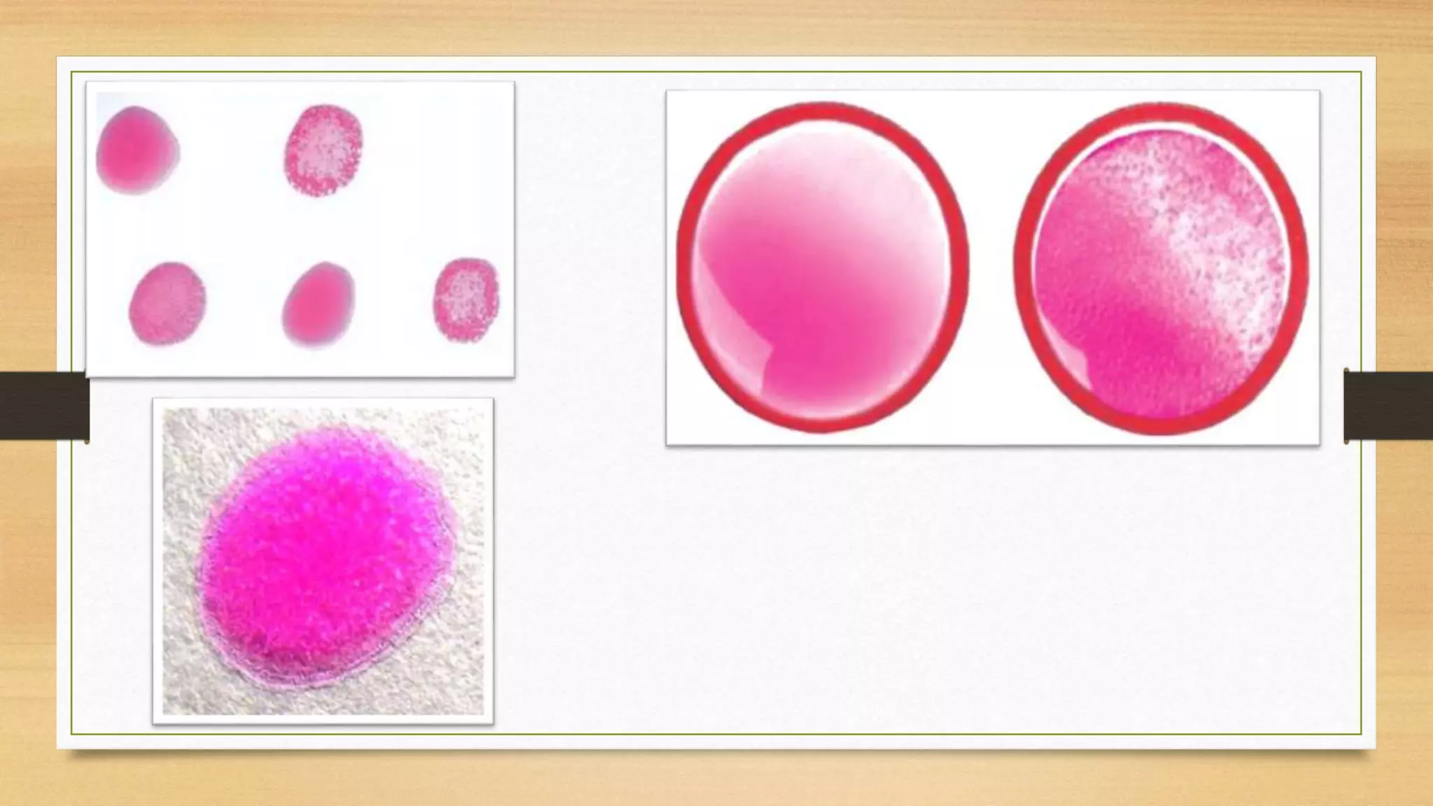 Rose bengal plate test | PPTX