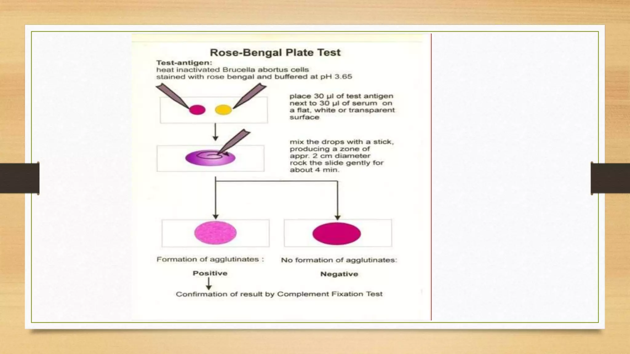 Rose bengal plate test | PPTX