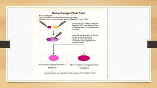 Rose bengal plate test | PPTX