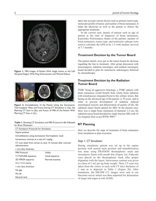 ROSE CASE BRAIN MET SRS | PDF