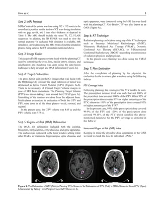 ROSE CASE BRAIN MET SRS | PDF