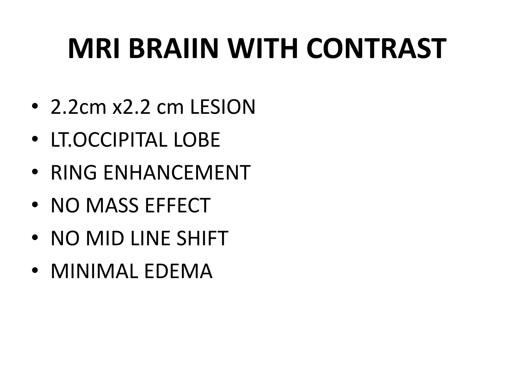 ROSE CASE OF SRS BRAIN METASTASIS | PPTX