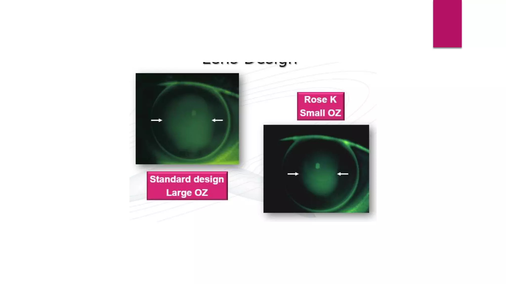 Rose K lens.pptx