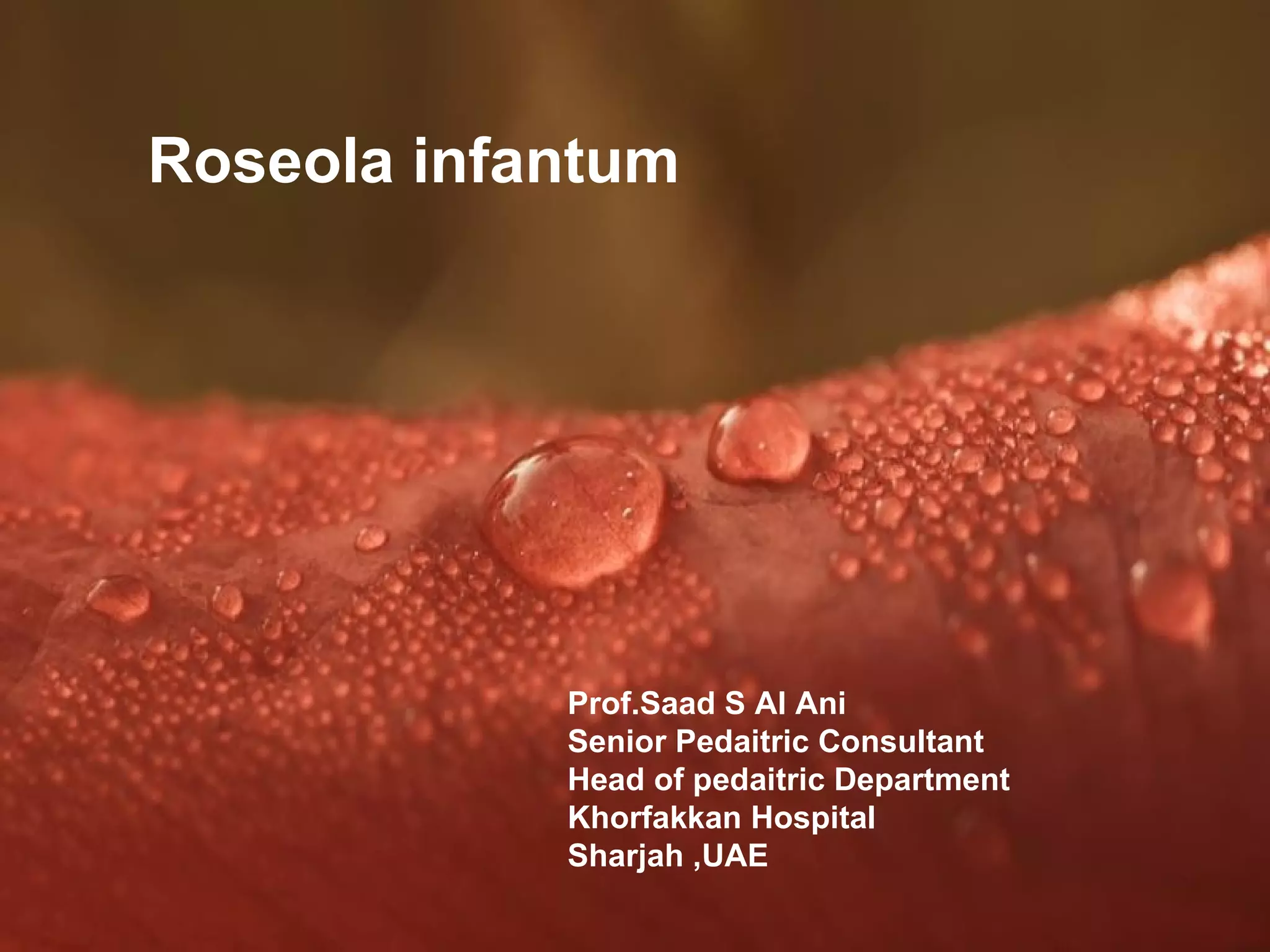Roseola infantum | PPT