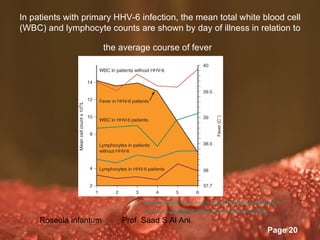 Roseola infantum | PPT