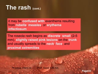 Roseola infantum | PPT