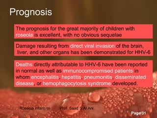 Roseola infantum | PPT