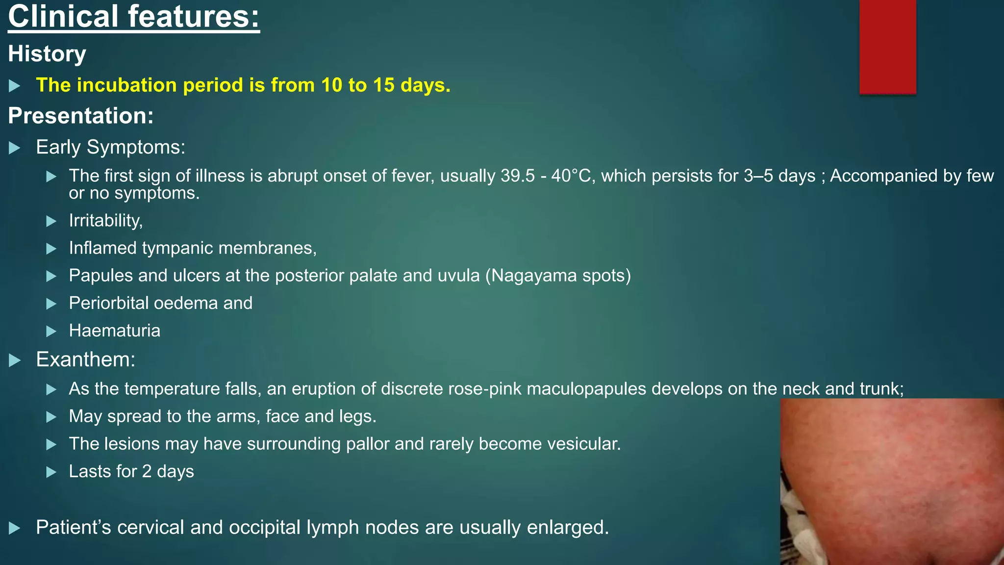 Roseola infantum Made Ridiculously Easy!!! | PPTX