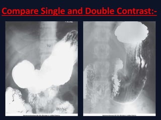 Barium series | PPTX