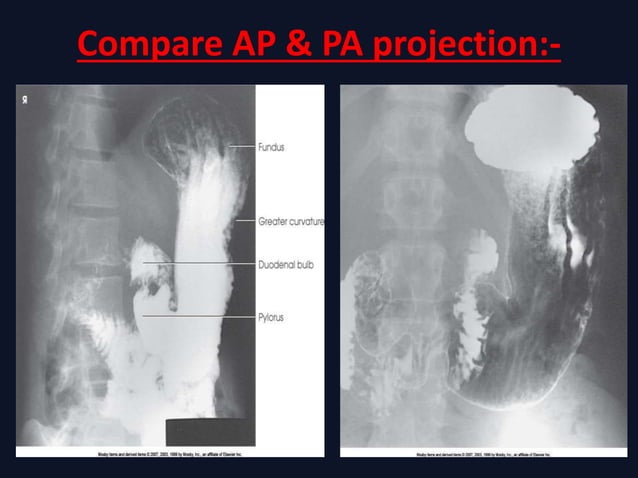 Barium series | PPTX
