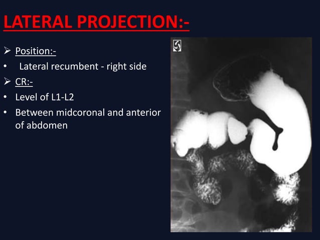 Barium series | PPTX