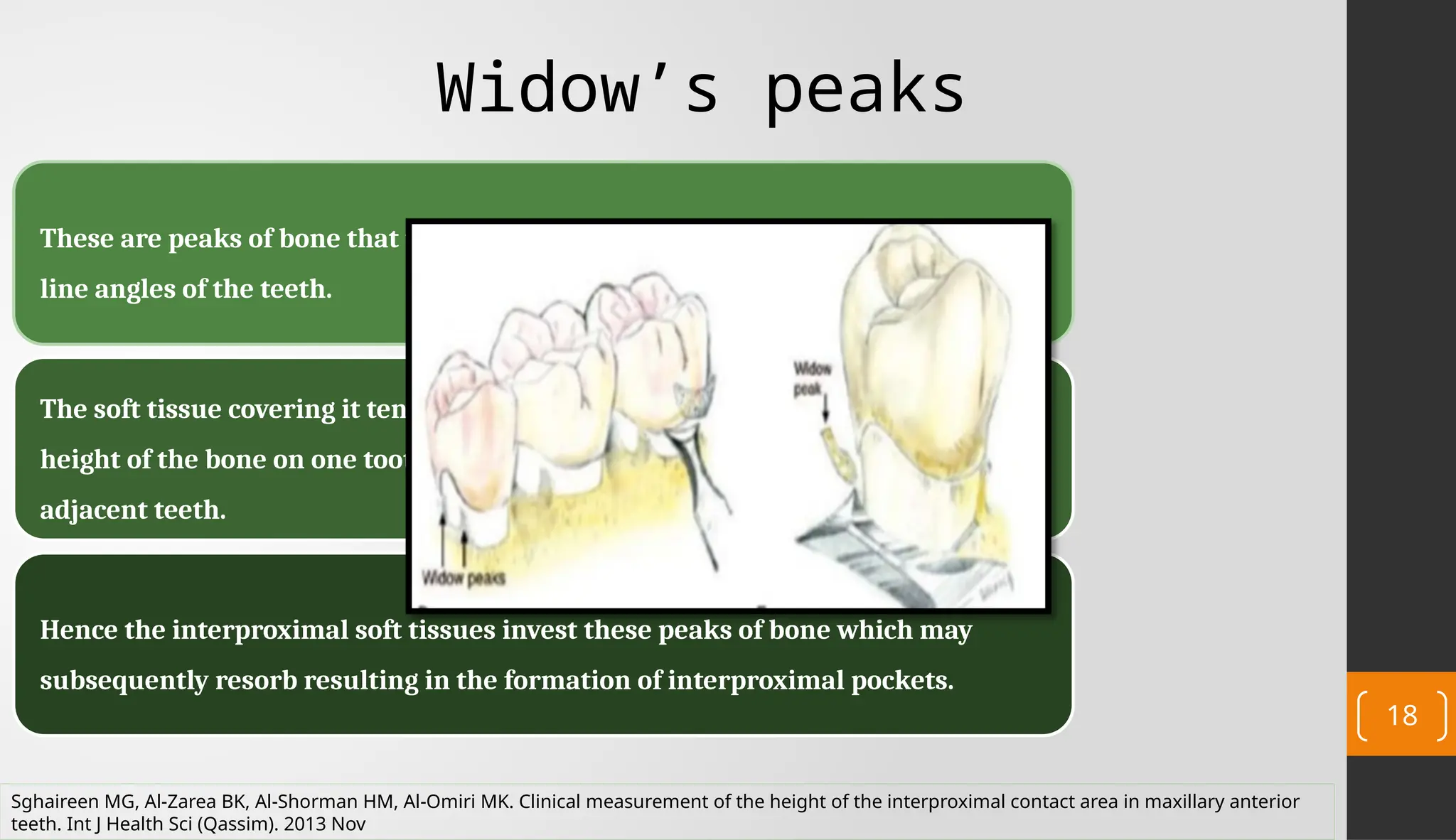 Resective osseous surgery In perio sem.pptx