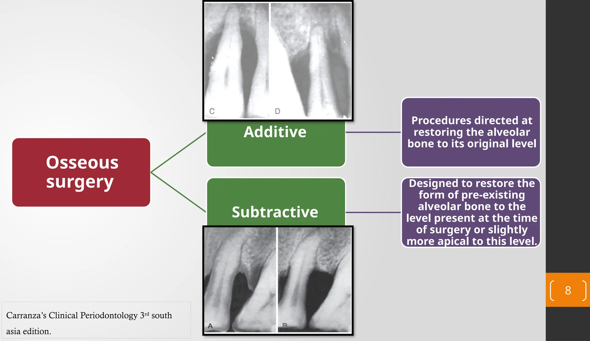 Resective osseous surgery In perio sem.pptx
