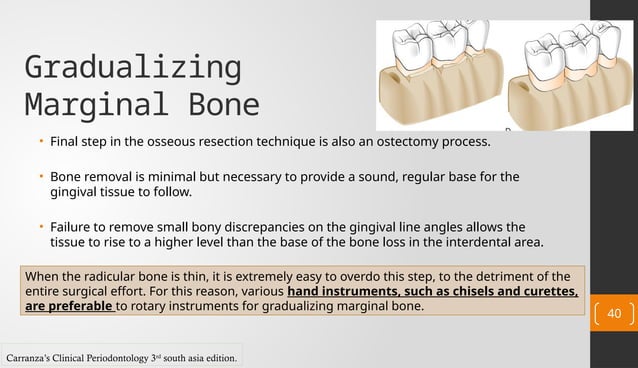 Resective osseous surgery In perio sem.pptx | Bone and Joint Conditions ...