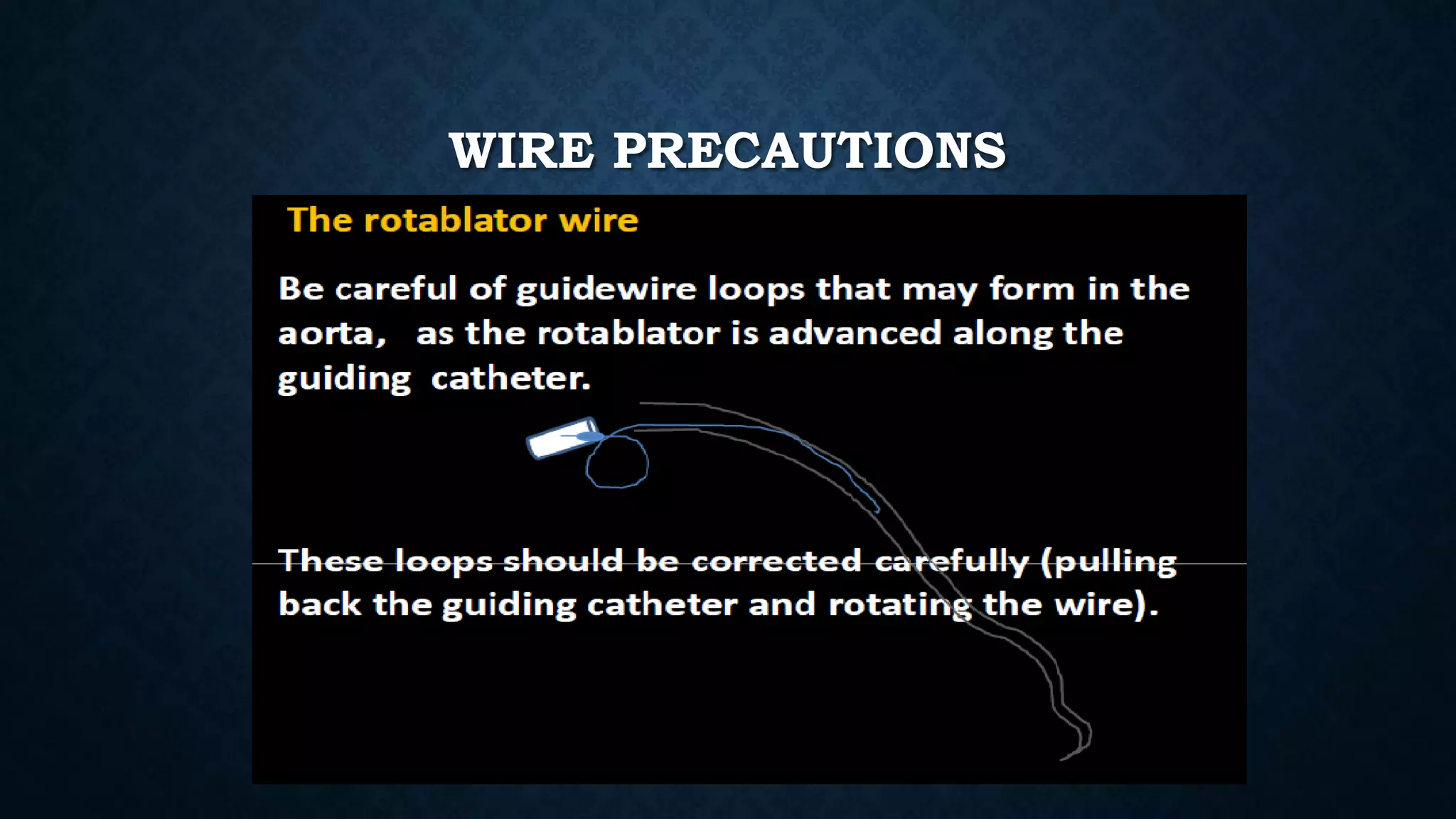 Rotablation - An overview | PPTX