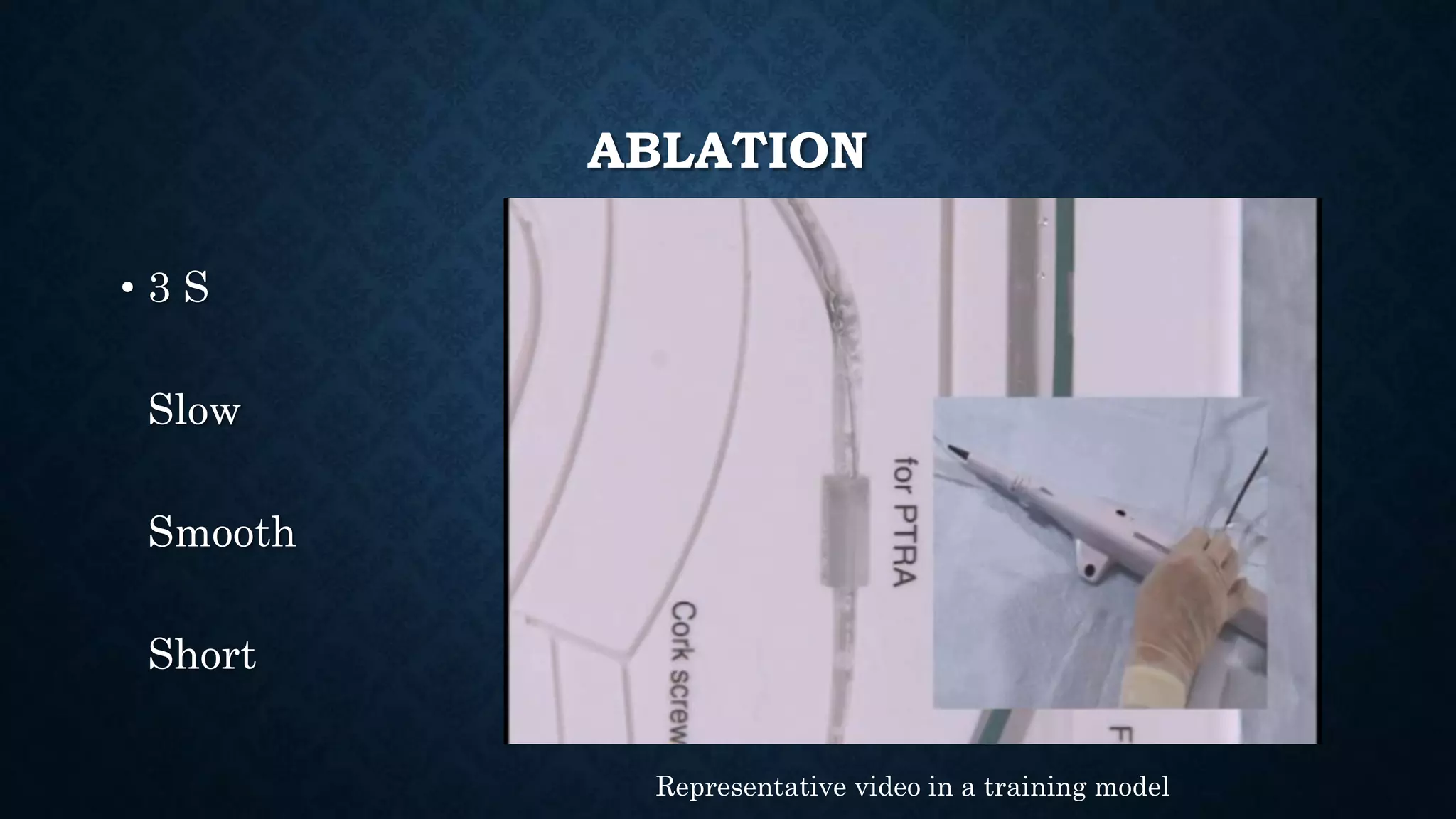 Rotablation - An overview | PPTX