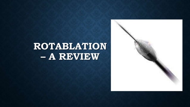 Rotablation - An overview | PPTX