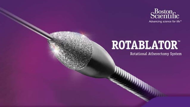 Rotablation - An overview | PPTX