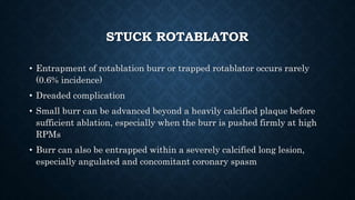 Rotablation - An overview | PPT