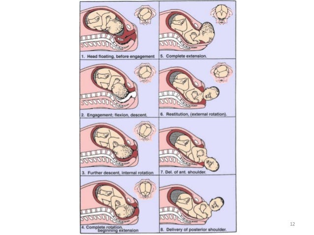 Rotacion en el parto de vertice 2 aaa