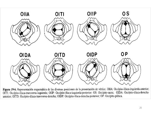 ROTACION EN EL PARTO OIIA Y OIDA Y FORCEPS 1AAA