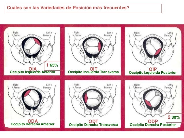 ROTACION EN EL PARTO OIIA Y OIDA Y FORCEPS 1AAA