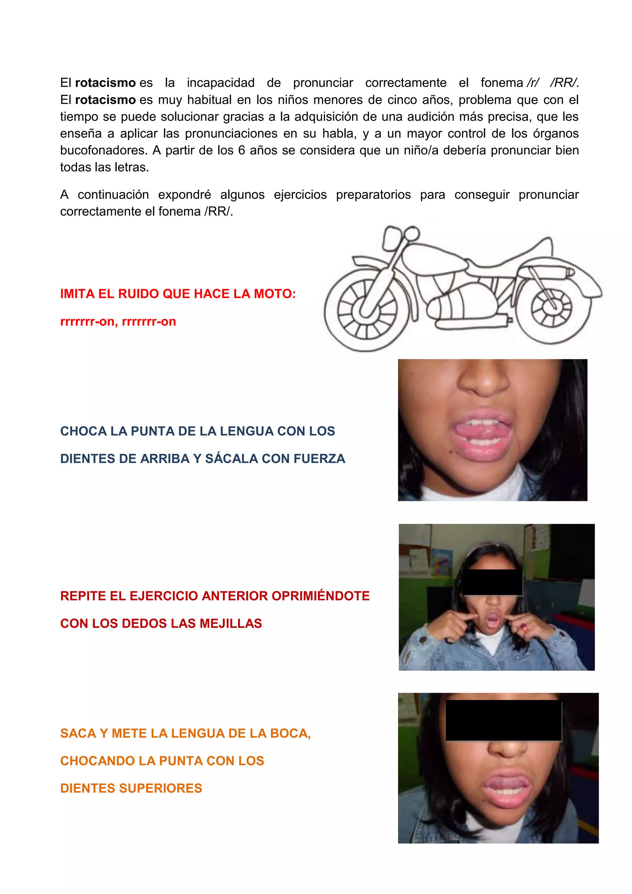 Ejercicios tratamiento Rotacismo | DOCX