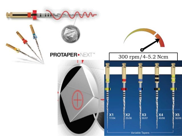 Rotary in endodontic
