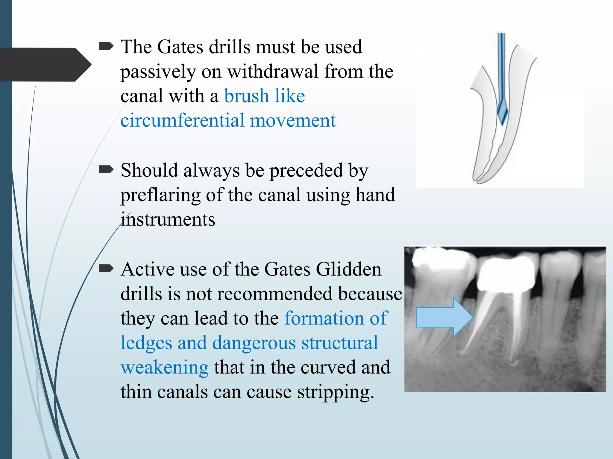 Rotary Endodontic Instruments | PPTX