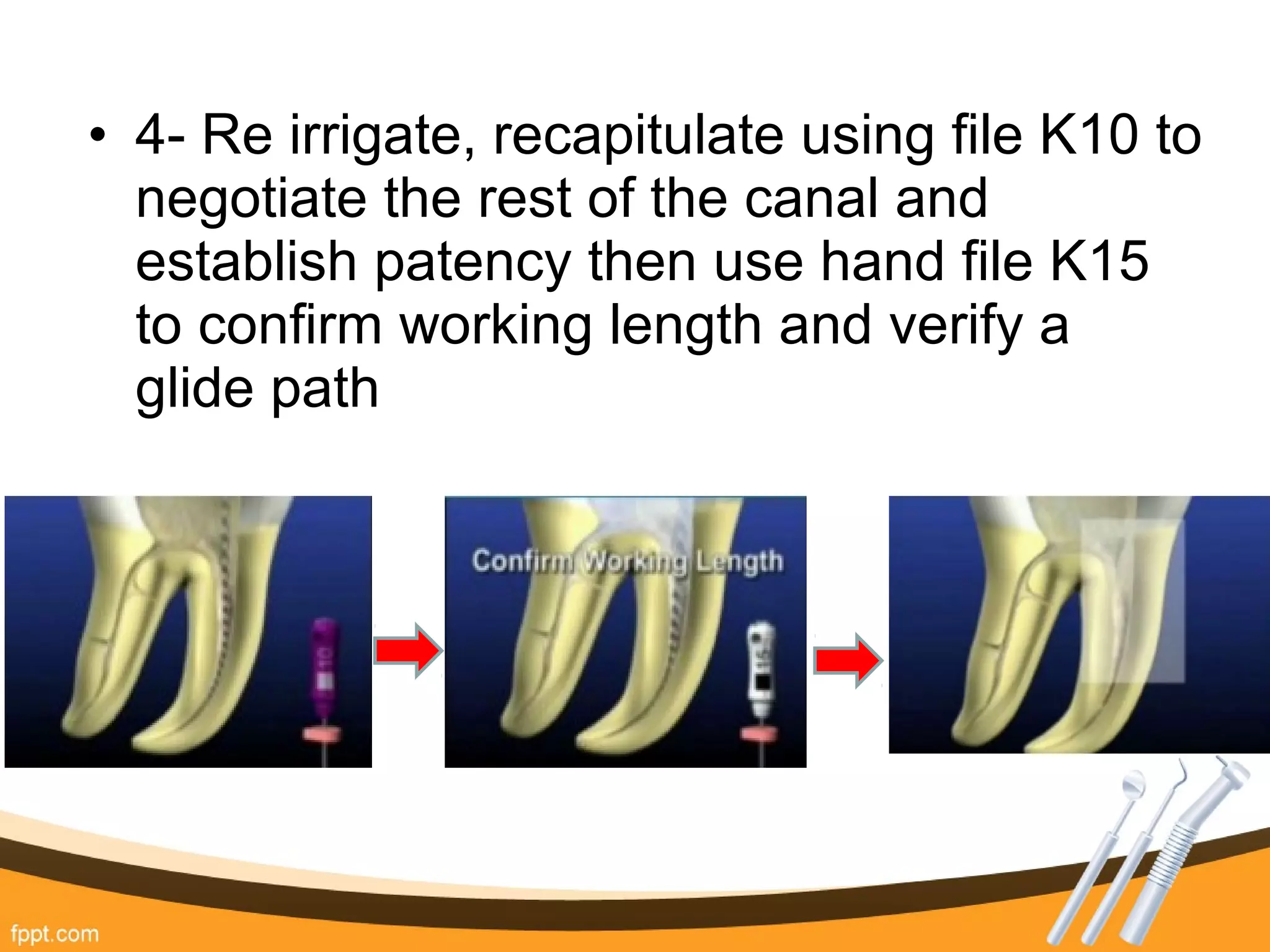 Rotary endodontic system, protaper feachers and techniques | PPT