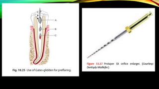 Rotary files.pdf فایل های روتاری و دستی | PDF