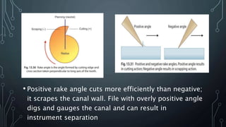 Rotary Files, generation and evolution, design advantages | PPTX