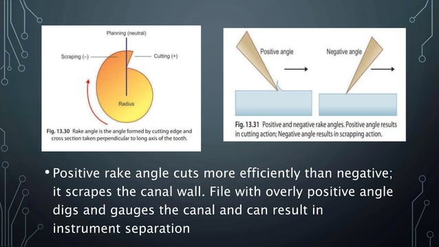 Rotary Files, generation and evolution, design advantages | PPTX