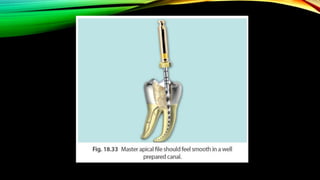 Rotary andd Hand files.pptxRotary andd Hand files.pptx | Dental Health ...