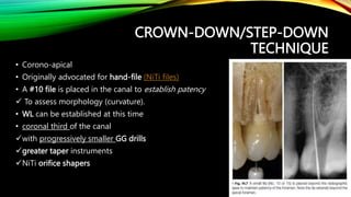 Rotary andd Hand files.pptxRotary andd Hand files.pptx | Dental Health ...