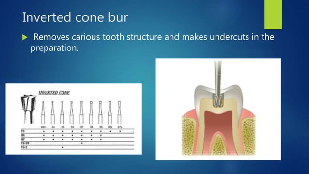 Rotary Instrument Identification | PPTX