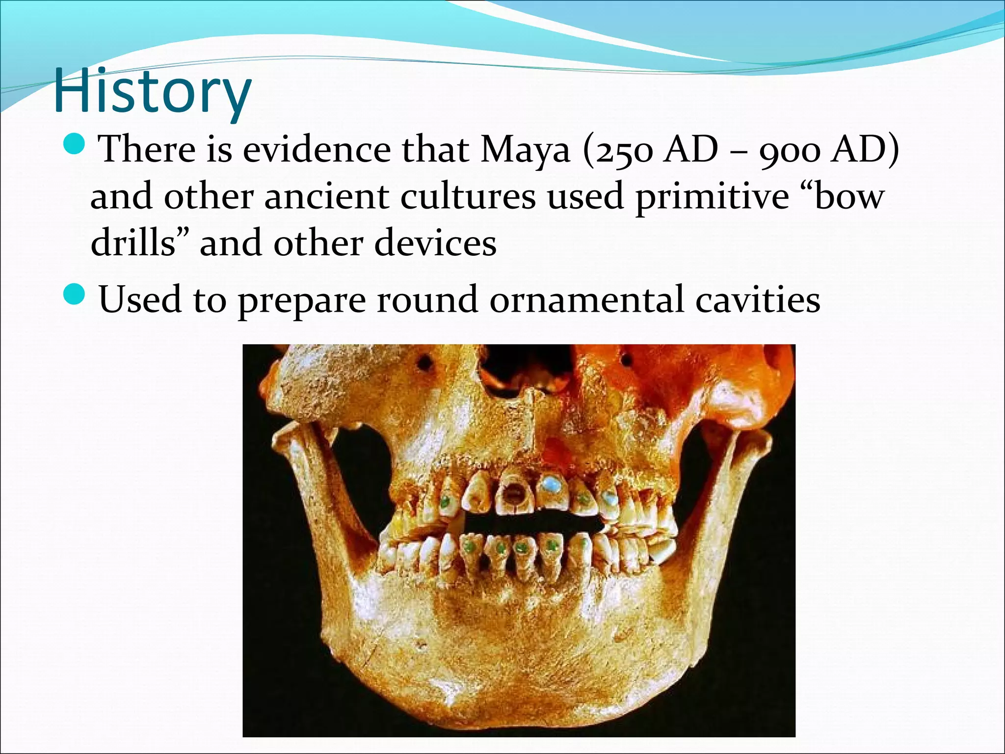Rotary instruments in operative dentistry | PPT