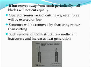 Rotary instruments in operative dentistry | PPT