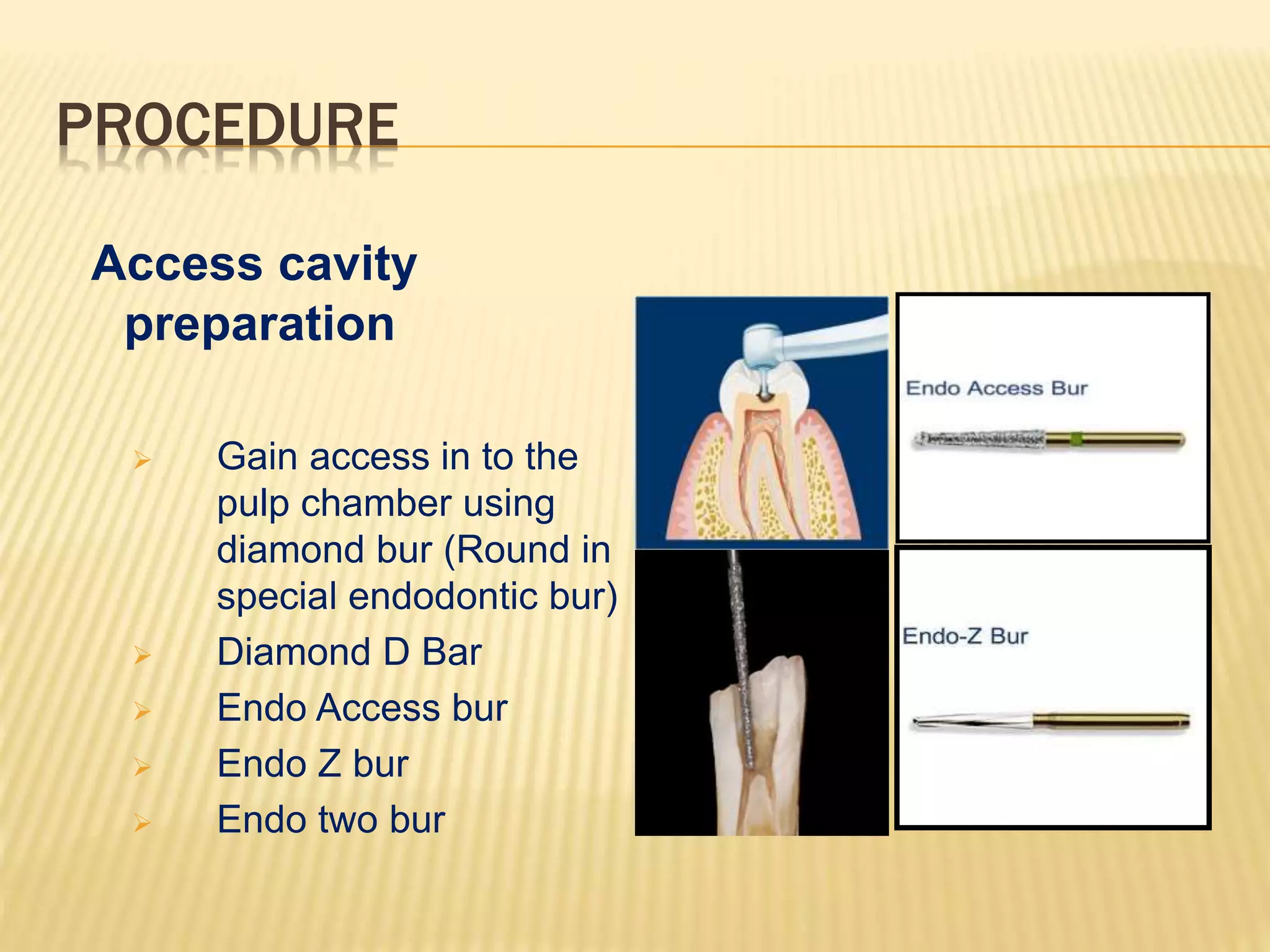 Rotary system in endodontic treatment | PPTX
