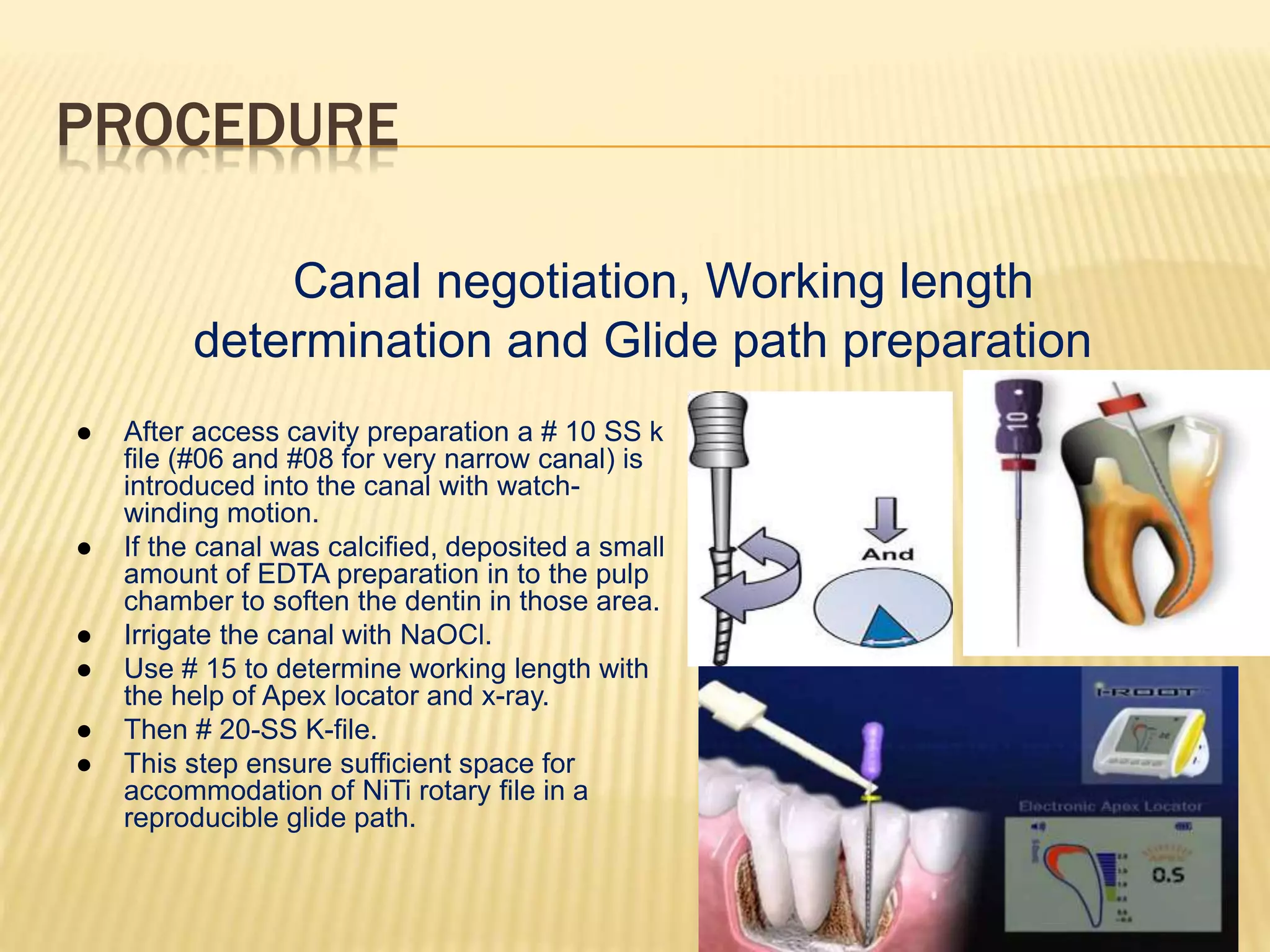 Rotary system in endodontic treatment | PPTX