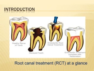 Rotary system in endodontic treatment | PPTX