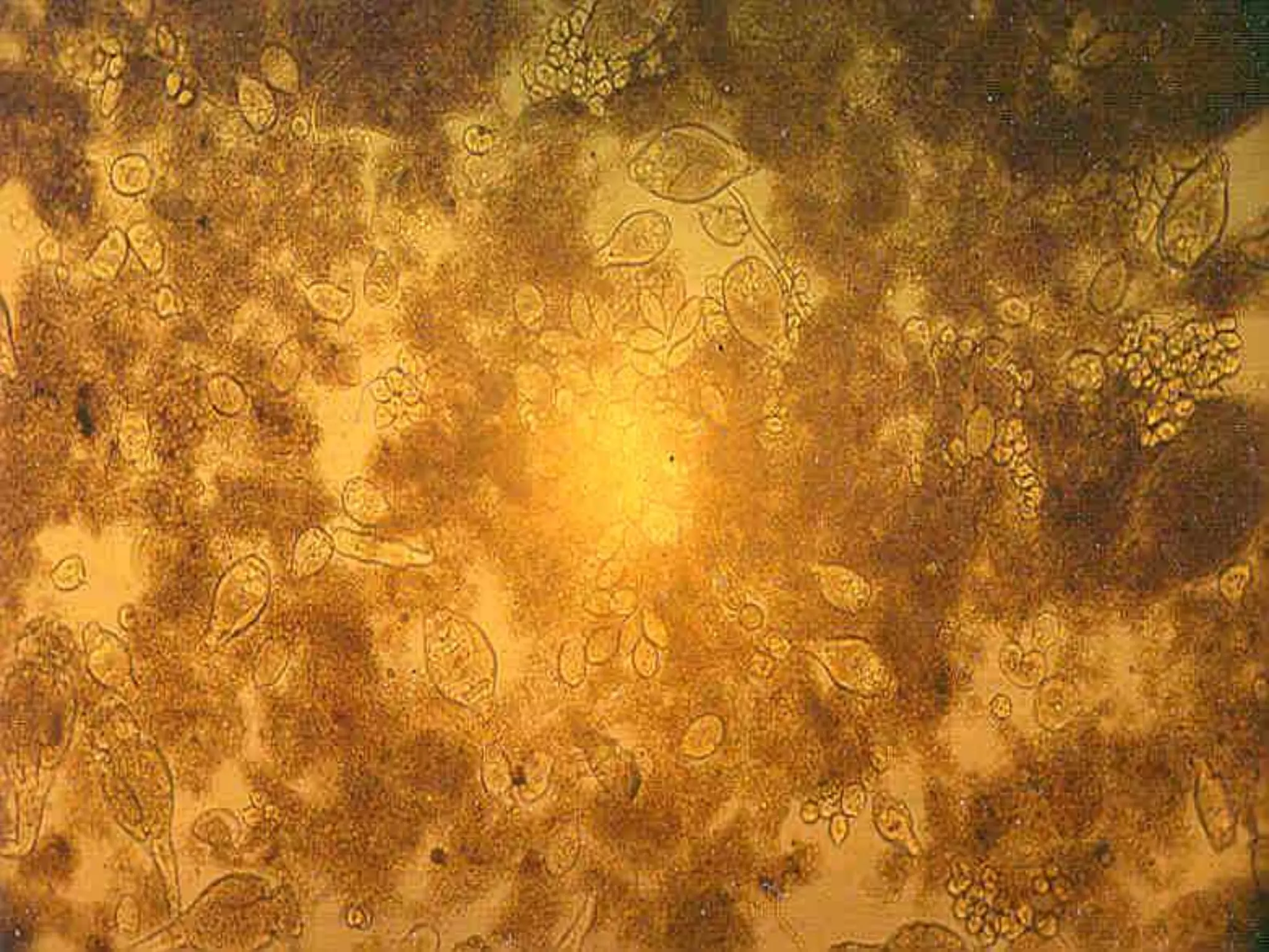 rotating-biological-contactor-process.ppt